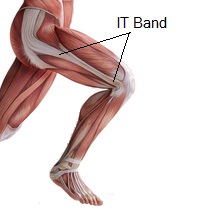 IT Band Syndrome - TRCC Total Rehabilitation and Chiropractic Centre